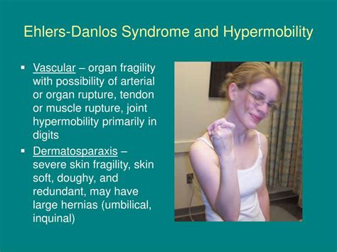 A Guide To Living With Ehlers Danlos Syndrome Hypermobility Type At