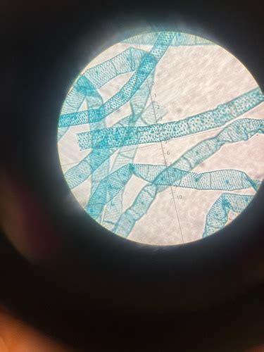 Bio Protists Flashcards Quizlet