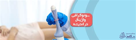 سونوگرافی واژینال در اندیشه کلینیک شاهد
