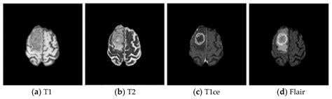 Applied Sciences Free Full Text A Multi Brain Tumor Region Segmentation Model Based On 3d U Net