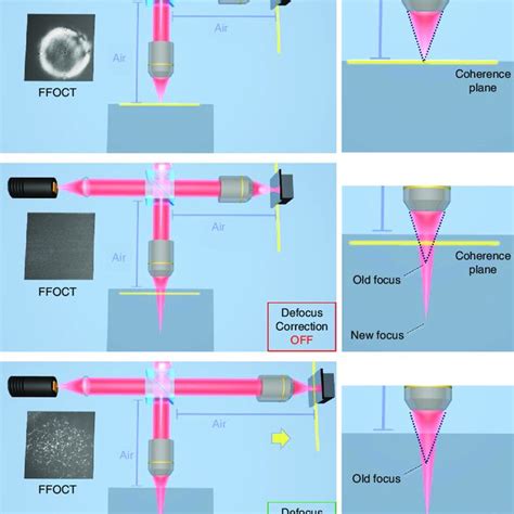 Principle Of Defocus Correction For Matching The Optical Arms Of Ffoct Download Scientific