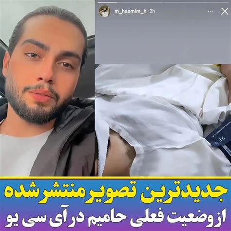 عکس های دردناک از حامیم در بیمارستان وضعیت جسمانی حامیم بعد 3 عمل جراحی