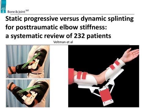 Cambridge University Hospitals NHS Trust Ppt Download