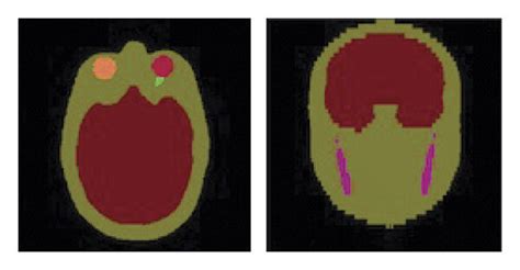 qualitative comparison of our method with supervised deep learning