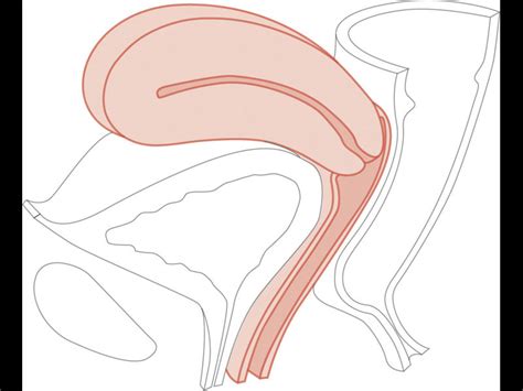 Cfpt Mk 3 Module 1 Normal Nulliparous Cervix Light Skin Tone Limbs And Things Global
