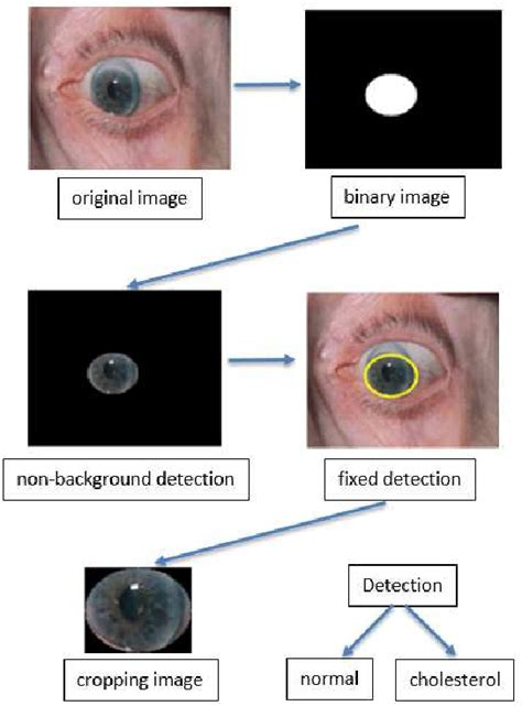 cholesterol detection through iris using daugman s and glcm based on k