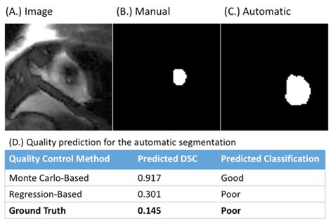 Example Of An A Input Image With B Its Manual Segmentation And C Download Scientific