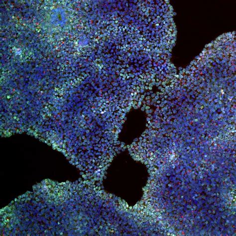 Try Our Free Cell Confluency Tool Cell And Gene Therapy Catapult