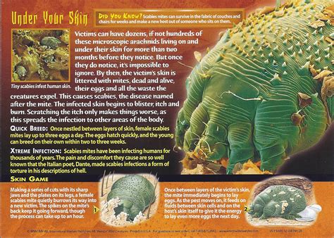 Scabies Mite Scabies
