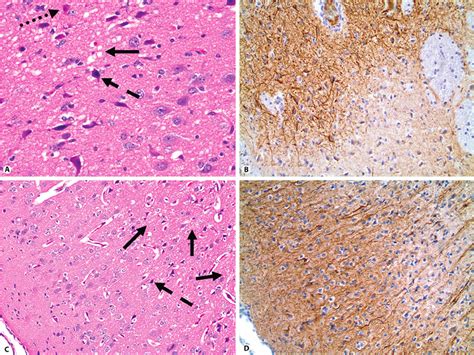 Striatum And Cortex Stained With He And Map 2 A He Download Scientific Diagram