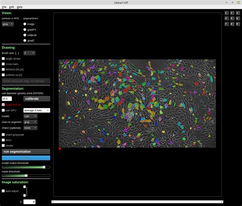 Does Not Work For Myoblasts And Embryonic Fibroblasts · Issue 385 · Mouselandcellpose · Github