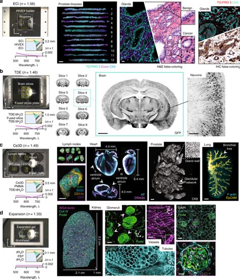 Multi Immersion Open Top Light Sheet Microscope For High Throughput Imaging Of Cleared Tissues