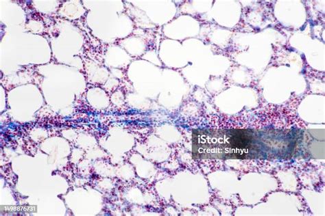 광학 현미경으로 본 인간의 폐 병리학 폐는 인간의 호흡기 기관입니다 코르티기관에 대한 스톡 사진 및 기타 이미지 코르티기관 Orchiepididymitis 건강관리와