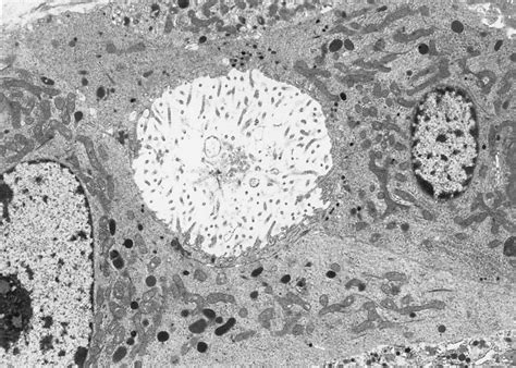 Electron Micrograph Showing An Intercellular Lumen Containing Download Scientific Diagram