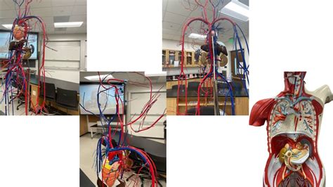 Upper Extremity Arteries Diagram Quizlet