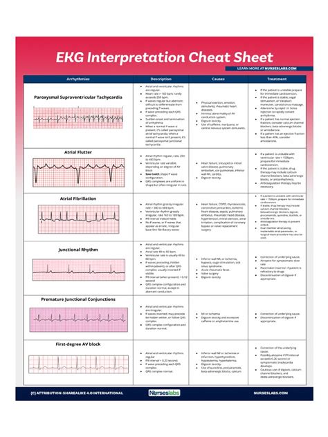 Ekg Interpretation Cheat Sheet For Heart Arrhythmias Nurseslabs 2 Pdf