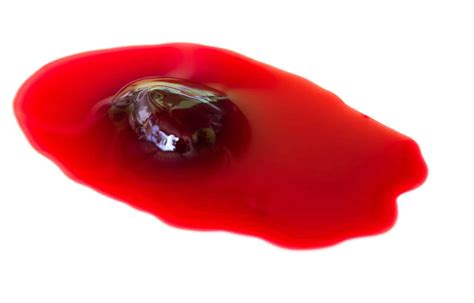 The No1 Warning Sign That You May Have A Blood Clot