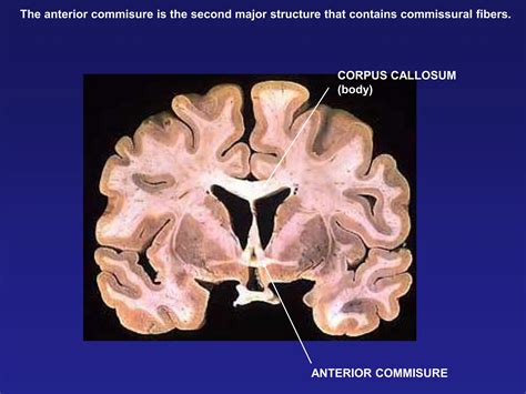 Physiology Of Cerebral Cortex Cerbral Cortexppt