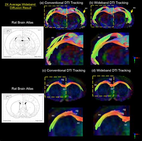 Diffusion Tracking Of 2x Average Coherent Wideband Epi Images Are Download Scientific Diagram