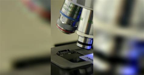 Begini Penampakan Setetes Sperma Dilihat Pakai Mikroskop Ada Jutaan Calon Manusia