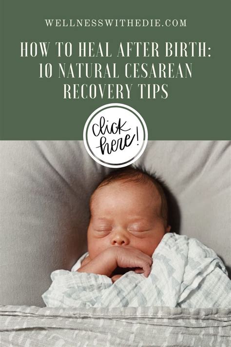 Congratulations Mama Recently Had A Cesarean Or Have One Planned For