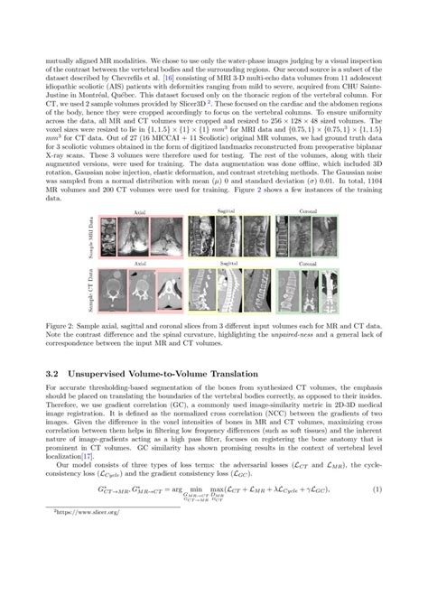 Three Dimensional Segmentation Of The Scoliotic Spine From Mri Using Unsupervised Volume Based