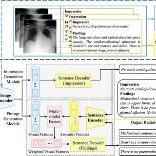 Multimodal Contrastive Learning For Radiology Report Generation Request Pdf
