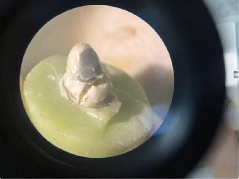 Fracture Occured Within 2 Mm Of Cervical Root Dentin And Considered As Download Scientific