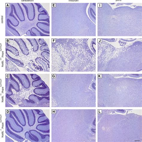 Luxol Fast Blue Staining A H Luxol Fast Blue Staining Of Sagittal Download Scientific Diagram