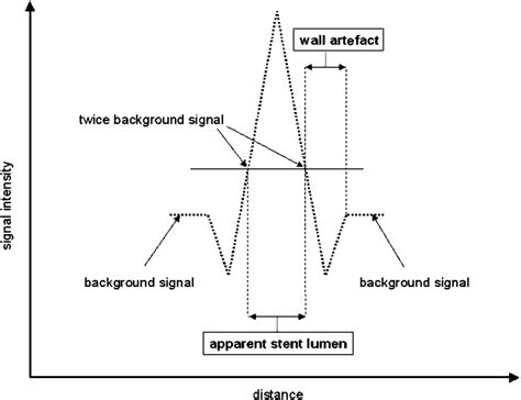 Schematic Of Signal Intensity Plot Dotted Line Perpendicular To Long Download Scientific