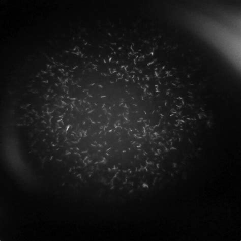 Fluorescence Microscopy Of Afb Via Auramine O Dye Fluorescent Smear