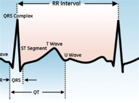 How To Measure And Assess A Long QT Interval GE HealthCare United States