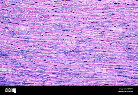 Light Micrograph Of Elastic Fibres In The Wall Of An Aorta The Aorta