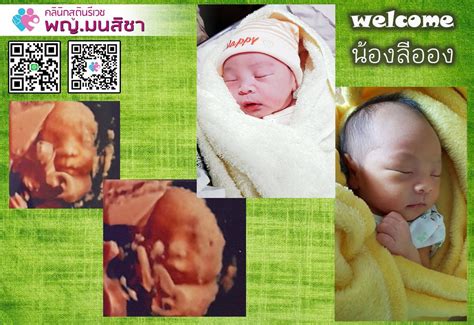🎉 ยินดีต้อนรับ “น้องลีออง” นะคะ 🎉 🎀 อัลตราซาวน์ 3 มิติ 4 มิติ ทำให้พ่อแม่สามารถเห็นลูกน้อยได้