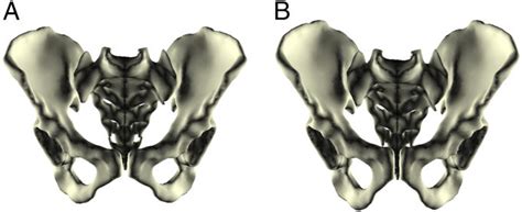 Sexual Dimorphism In The Human Pelvis A The Average Female Pelvis