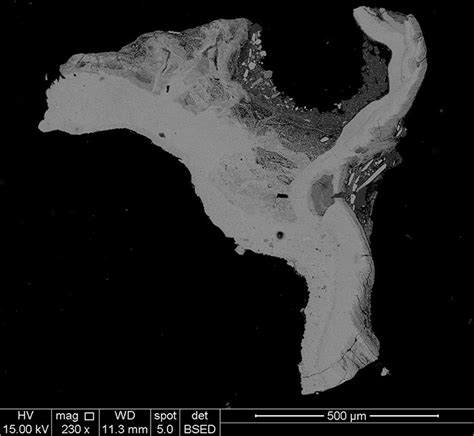 Fragment Of A Typical Tubercle Download Scientific Diagram