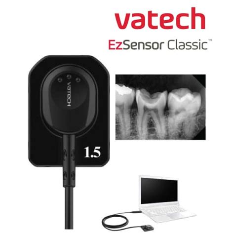Ezsensor Classic 15 Galla Dental
