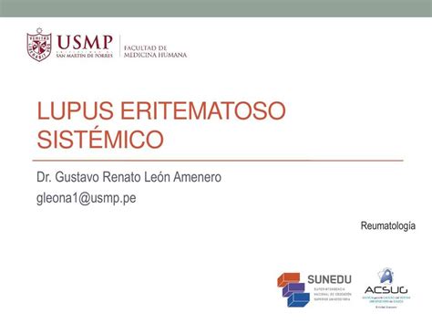 Lupus Eritematoso Sistémico Natalie Sosa Udocz