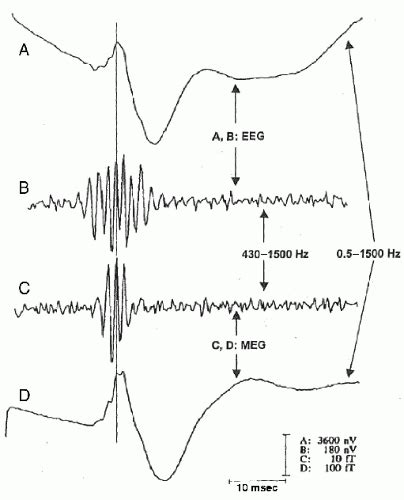 High Frequency EEG Activity Neupsy Key
