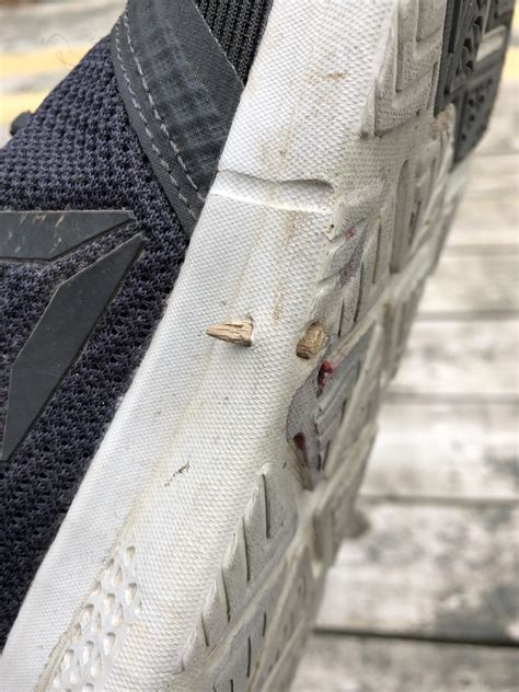 Tree Almost Sucking On Me Surprised To See This After My Run This Morning R TreesSuckingOnThings