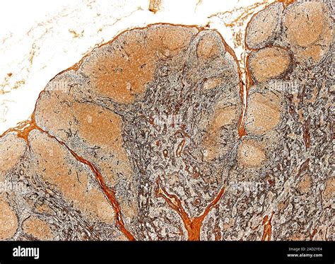 Light Microscopy Of Part Of A Lymph Node Stained To Show The Connective Reticular Tissue