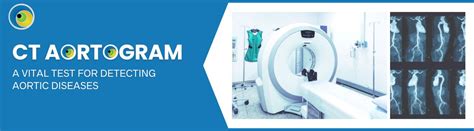 Ct Aortogram A Vital Test For Detecting Aortic Diseases Usmanpura
