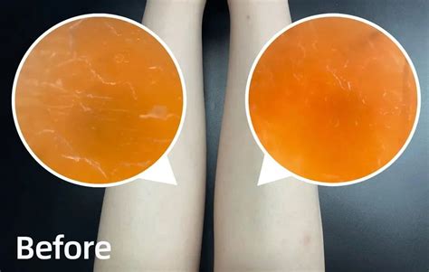 身体乳坚持涂 vs 不涂皮肤有多大区别我们做了个人体实验 丁香医生