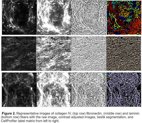 Customizing A Model For Fiber Segmentation Part 4 Analyzing The Results Carpenter Singh Lab