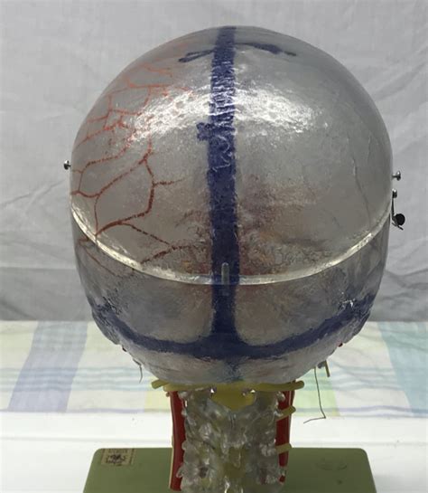 Ap2 Lab 3 Diagram Quizlet