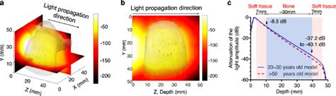3d Simulation Of The Light Distribution In The Bone And The Covering