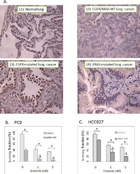 A Representative Yap1 Ihc Staining With Tissue Microarrays Constructed