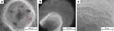 A Sem Micrograph Of Ablation Feature In Bovine Cortical Bone Created