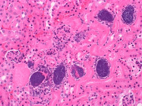 A New Regulator Of Staphylococcus Aureus Virulence Research Communities By Springer Nature