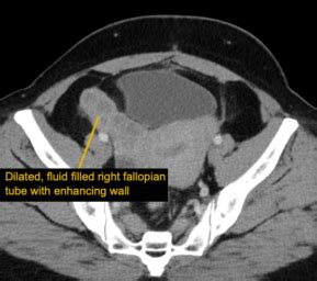 CT Case LITFL CT Scan Interpretation